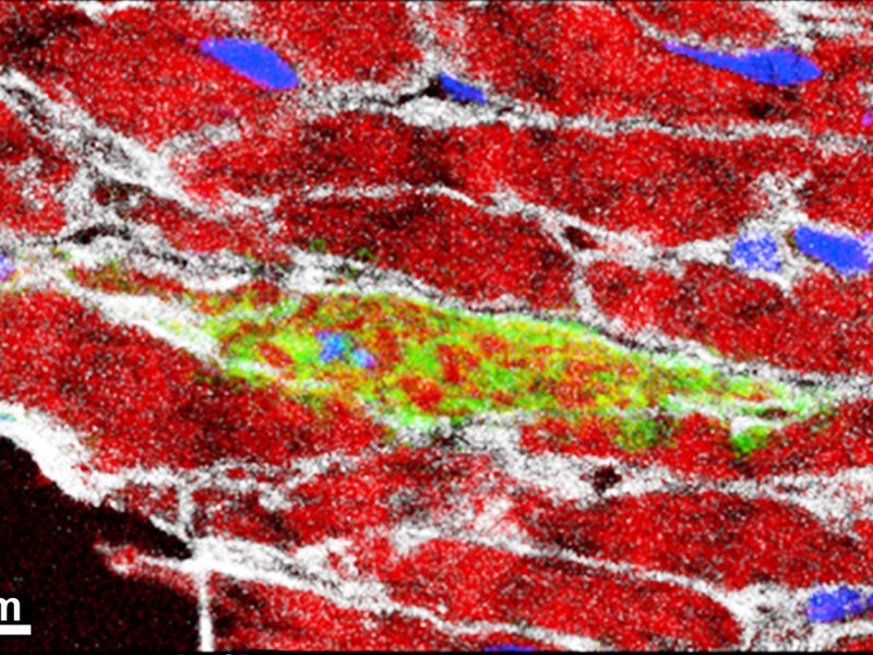 The heart’s own stem cells play their part in regeneration | Max Planck ...