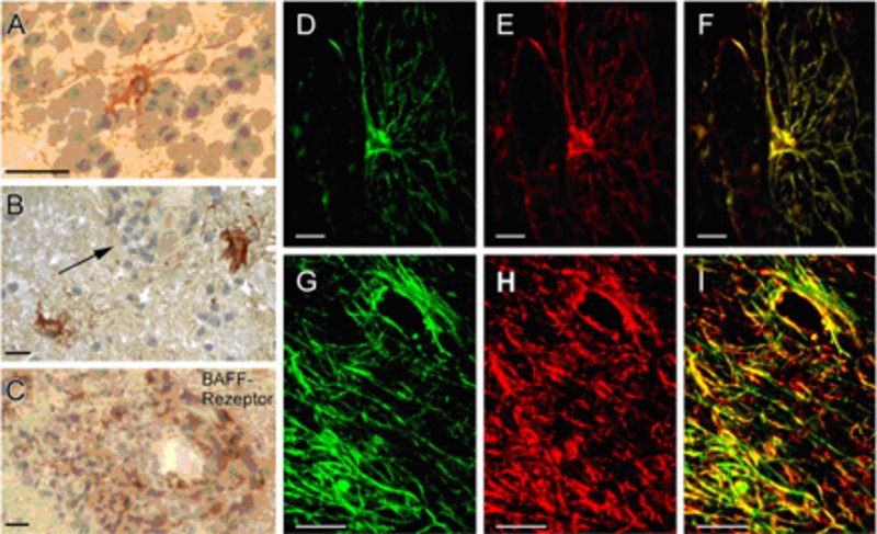 Immunfluoreszenz